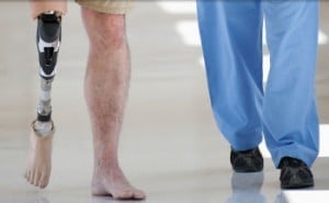 Workers' Comp & Social Security Disability For Loss of Limb
